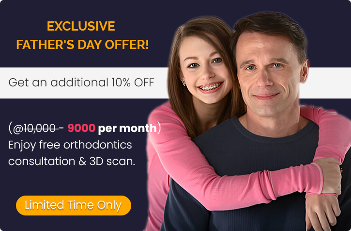 students special discounts get additional 10 % off on aligners get free ...